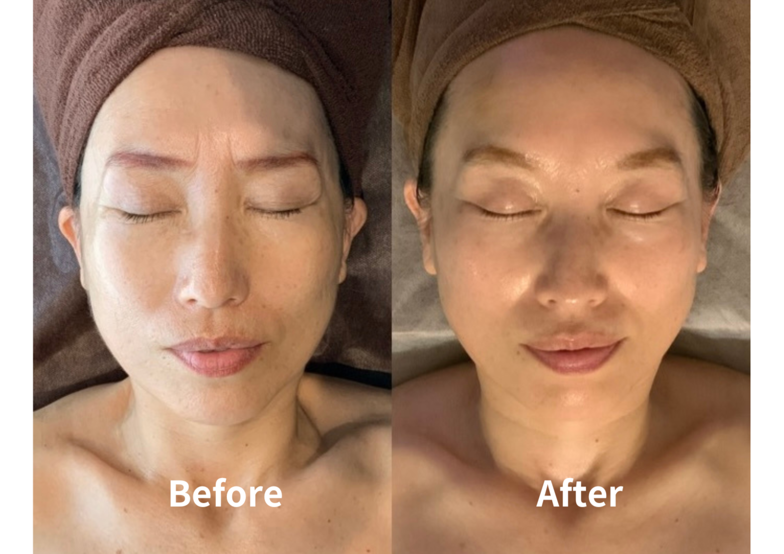 大船駅徒歩5分・小顔リフトアップ特化サロン | Koah facial salon 大船駅徒歩5分・小顔リフトアップ特化サロン | Koah facial salon